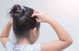 Mabisang gamot sa Kuto at Lisa: Paano tanggalin ang mga Kuto - Gamot sa Kagat